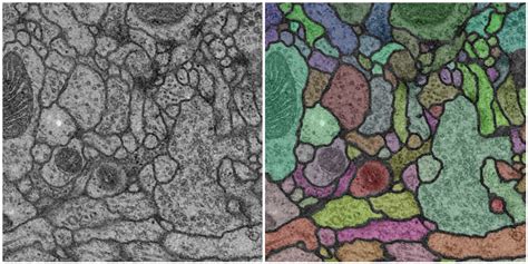 segmentation of neuronal structures in em stacks challenge isbi 2012