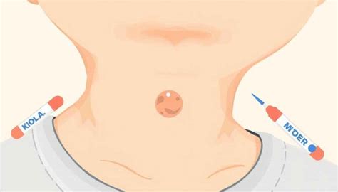 Caroço No Pescoço De Criança Causas E Quando Se Preocupar