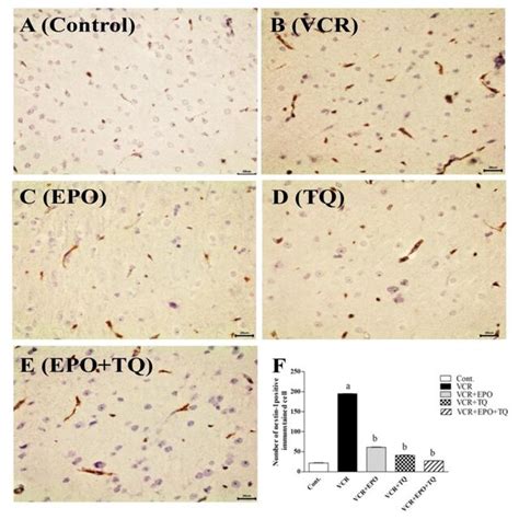 Immunohistochemical Nestin Staining Of Cerebral Cortex In Rat Brains