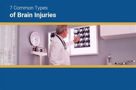 7 Common Types Of Brain Injuries