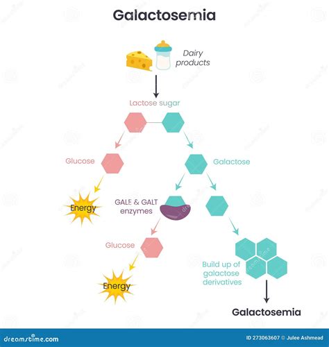 Galactosemia GALE GALK GALT Enzymatic Deficiency Science Vector