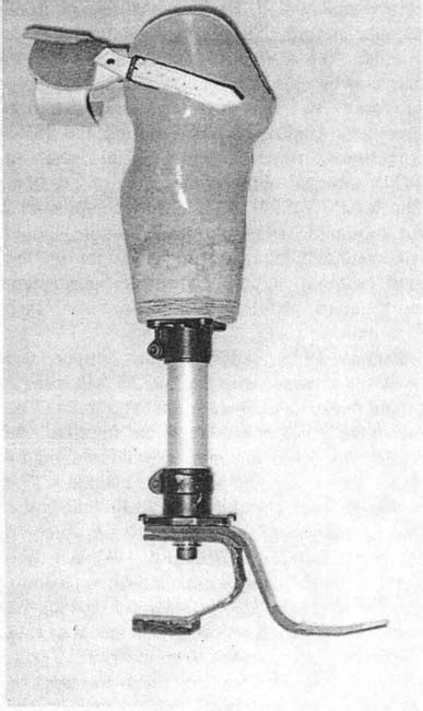 Lateral View Of The Lambda Foot Download Scientific Diagram