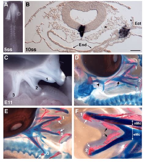 Effect Of Qt6 Shh Cell Graft In Ba1 Presumptive Territory On Lower Jaw