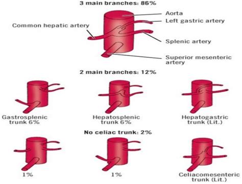 View Of Surgical Anatomy Of Coeliac Trunk Variations An Autopsy Series