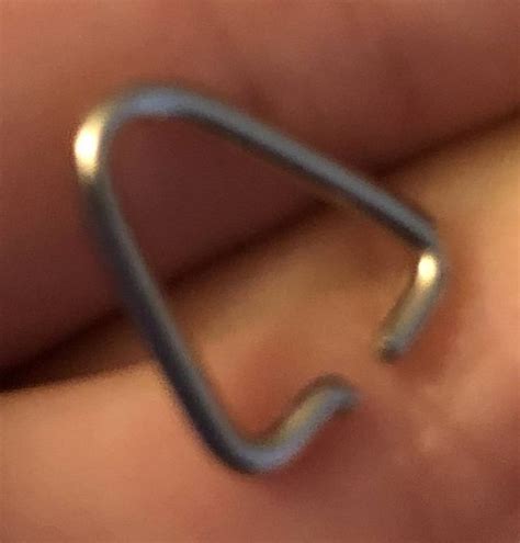 There Is A Witness In This Story Weird Brace Appearing Out Of Nowhere