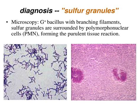 Ppt Actinomyces And Nocardia Powerpoint Presentation Free Download