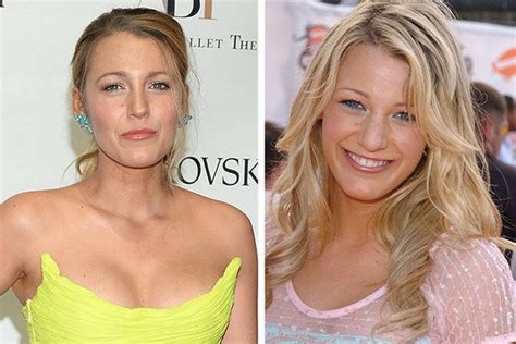 Jodie Marsh Before And After