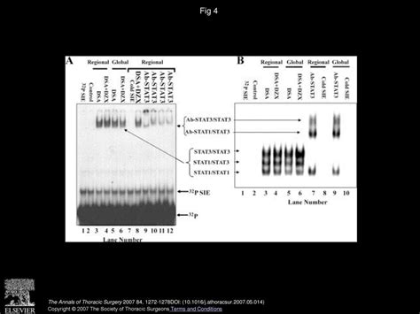Cardioplegia And Diazoxide Modulate Stat3 Activation And Dna Binding
