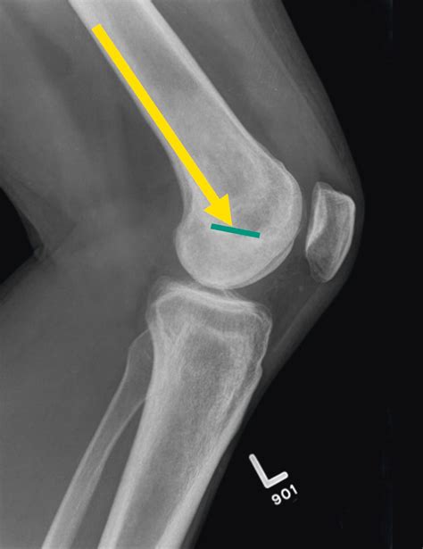 Treatment Of Associated Soft Tissue Injuries Clinical Tree