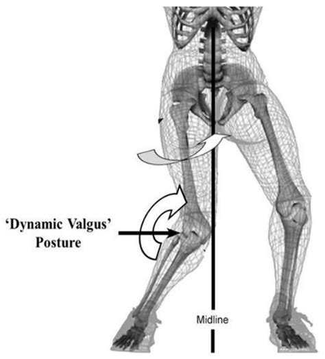 Internal Rotation Knee