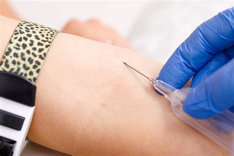 간호사는 정맥을 수행하는 팔 정맥에서 혈액 샘플을 채취합니다 2명에 대한 스톡 사진 및 기타 이미지 2명 간호사 건강 검진 Istock