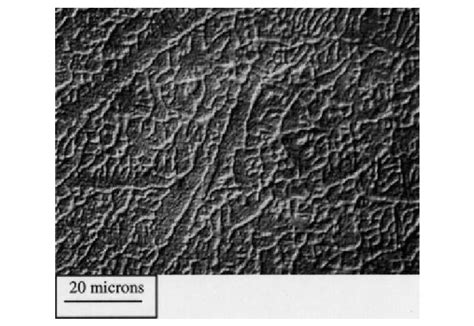 Large Dendrite Microstructure Power 1200 W Velocity 8 5 Mm S Download Scientific Diagram