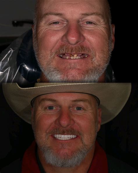 Its Coming 🚀 Nathan Kupperman Dmd