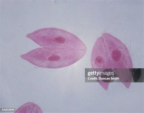 Paramecium Slide Labeled