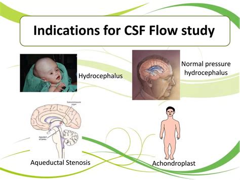 Csf Flow Study PPTX