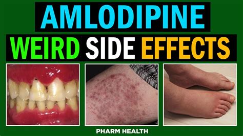 8 Weird And Unexpected Side Effects Of Amlodipine Skin