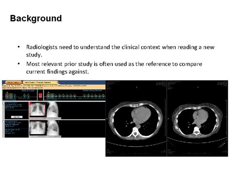 Determining Scanned Body Part From DICOM Study Description