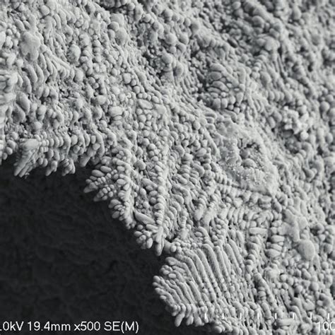 Dendritic Microstructure Sem Microphotography Slag From The Electric Download Scientific