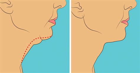 5 Exercises To Avoid Stubborn Double Chin