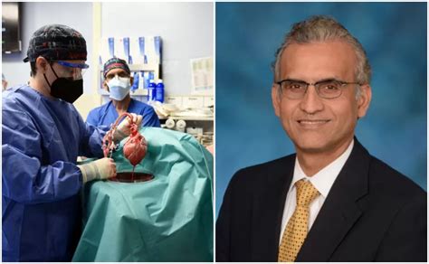 4 Fakta Menarik Muhammad Mohiuddin Dokter Di Balik Transplantasi