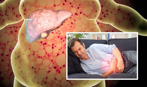 Fatty Liver Disease Swelling In Your Stomach Means You Should Tell