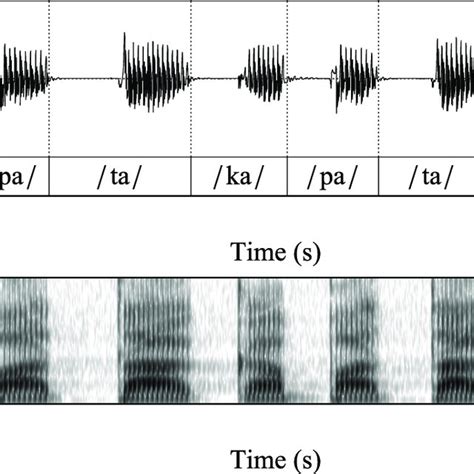 Speech Waveform And Spectrogram Of A 35 Years Old Normophonic Speaker Download Scientific