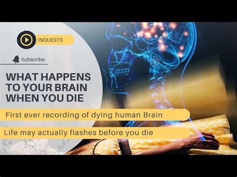 What Happens To Your Brain When You Die First Ever Recording Of Dying