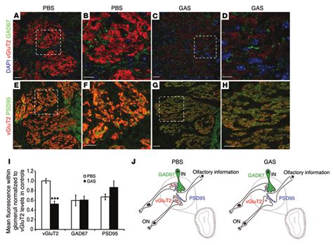 T Cell Accumulation In The Ob Is Accompanied By Loss Of Vesicular
