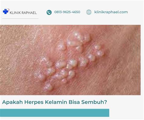 Susah Buang Air Kecil Inilah Penyebab Dan Cara Mengatasinya