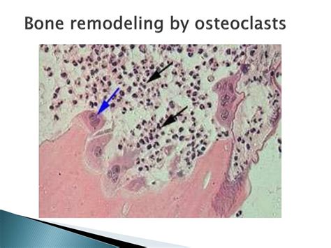 Ppt Chapter 5 The Skeletal System— Part A Powerpoint Presentation Id 2360108