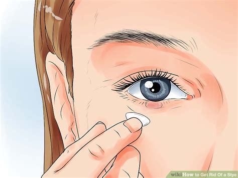 How To Get Rid Of A Stye Steps With Pictures WikiHow