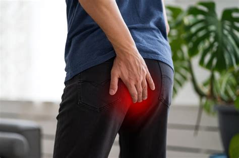 No One Wants To Deal With A Bad Case Of Hemorrhoids