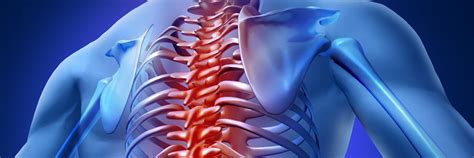 Osteochondrose Symptome Ursachen Therapie Herbano Йога для полных Сколиоз Йога