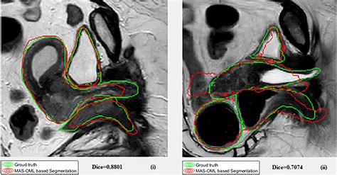Segmentation Examples Using Mas‐oml This Figure Displays The