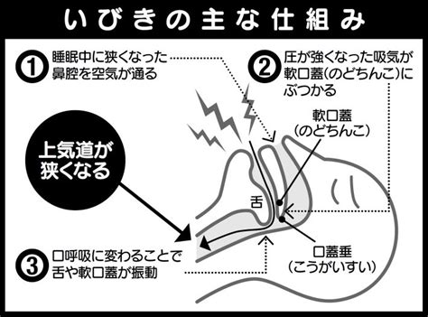 「寝た気がしない」原因のひとつ“いびき”。医師が教える改善法3つ 女子spa！