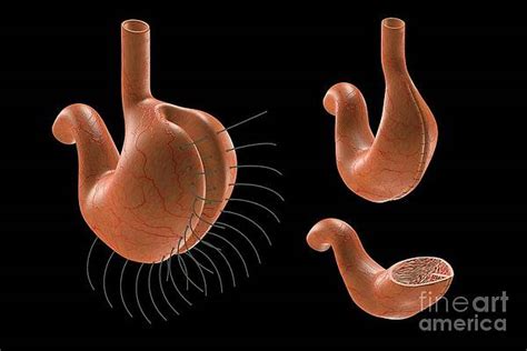 Bariatric Wall Art Fine Art America