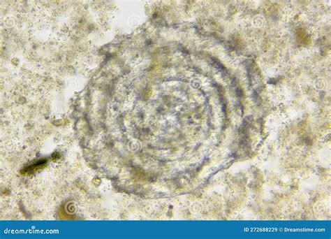 Microscopic View Of Unspecified Marine Microfossil Extracted From