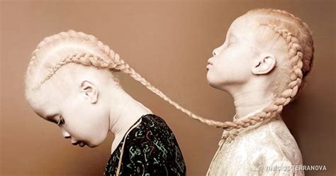 The Utterly Unique Appearance Of These Twins Has Stunned The Internet