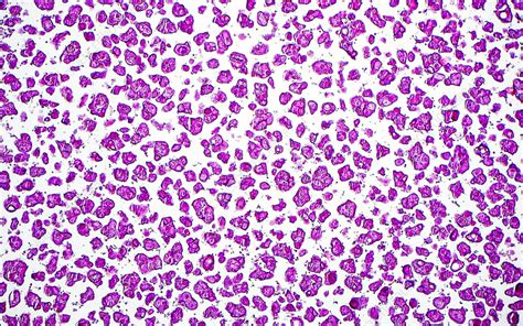 Corpora Amylacea Light Micrograph Stock Image C0602717 Science Photo Library