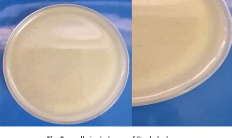 Figure 1 From Isolation And Characterization Of Lytic Bacteriophages From Sewage At An Egyptian