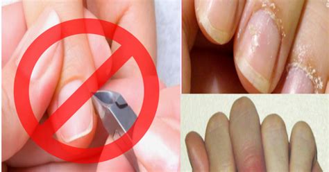 Curiosidades e dicas Como Remover as Cutículas SEM Alicate em 5 Minutos