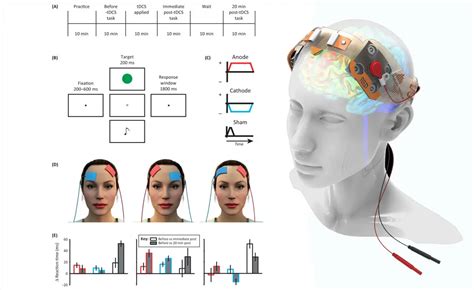 Understanding Tdcs For Depression Treatment At Tsc