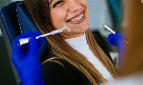 Fastest Way To Get Braces Off Tips For A Quicker Treatment