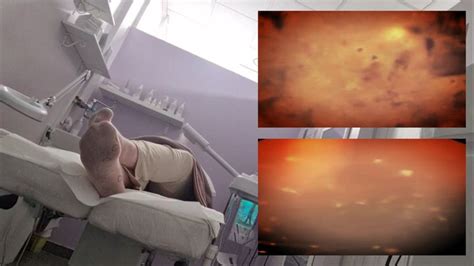 Nicoletta S Bold Adventure Exploring Her Stomach With Vore Pillcam And The Experience Of