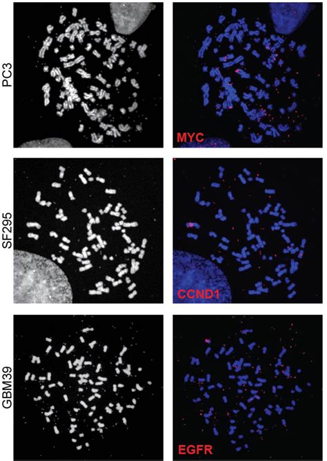 Extrachromosomal Oncogene Amplification Drives Tumor Evolution And