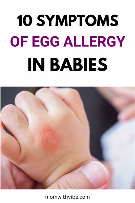 10 Symptoms Of Egg Allergy In Babies Mom With Vibe