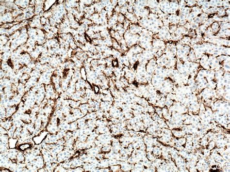 Vimentin Antibody 60330 1 Ig Proteintech