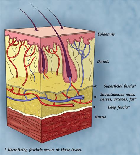 Necrotizing Fasciitis Bacteria Structure