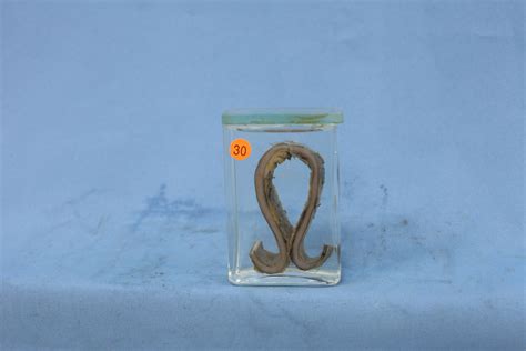 总论32 30 胸膜增厚玻璃样变