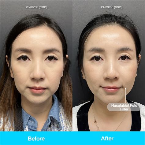 หน้าแรก En Aura Bangkok Clinic